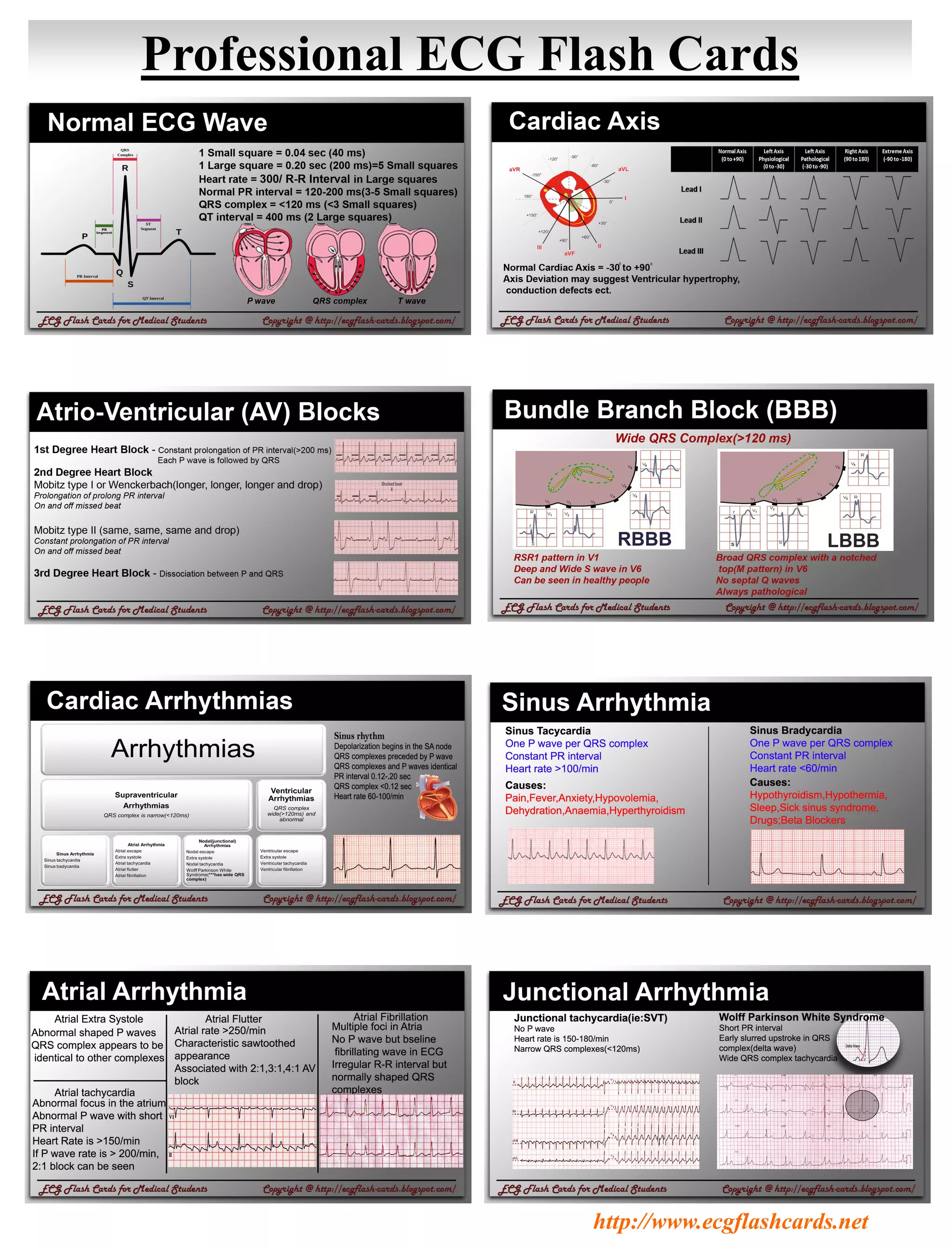 Ecg flash cards_new_complete | PDF | Heart and Cardiovascular Diseases | Diseases and Conditions