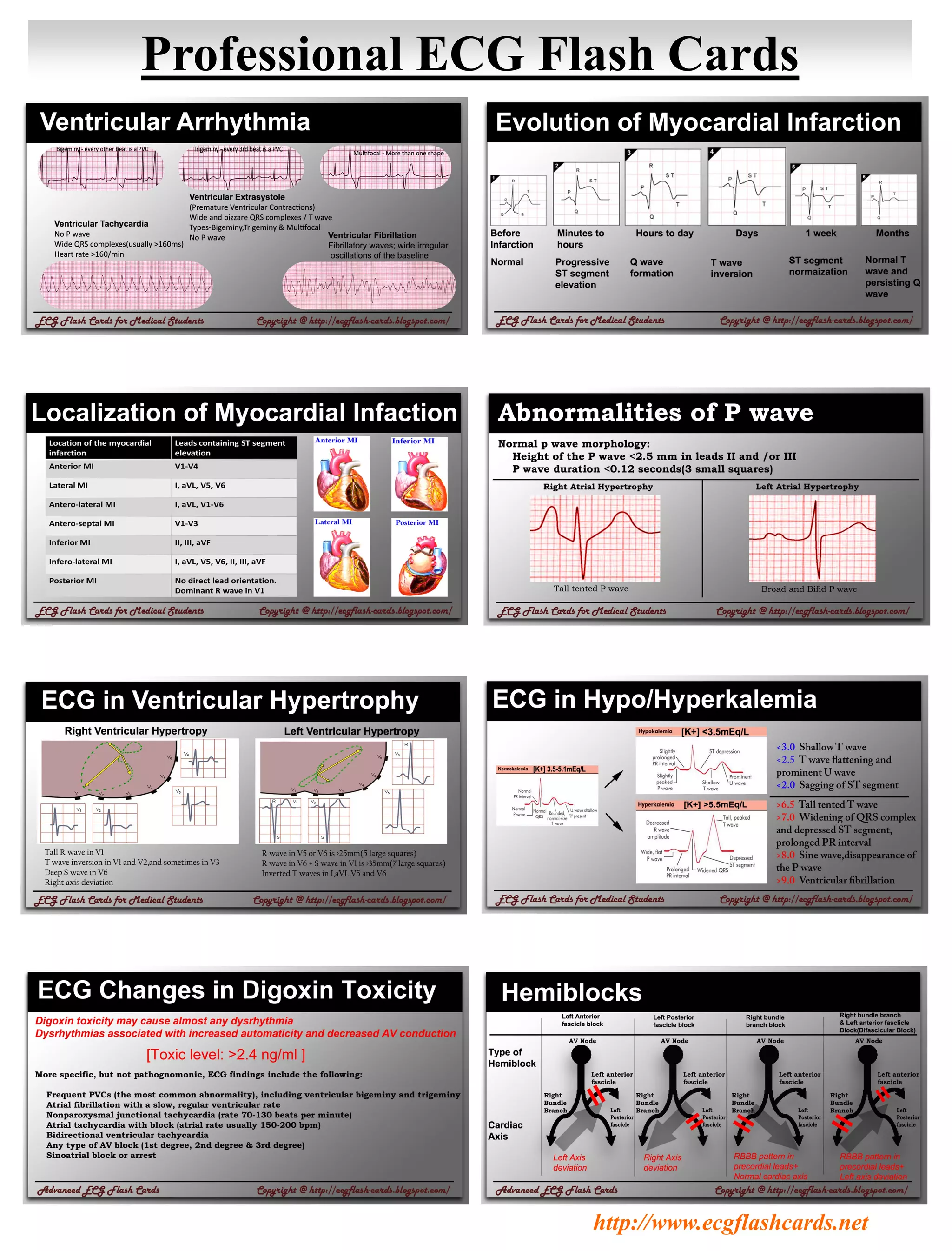 Ecg flash cards_new_complete | PDF