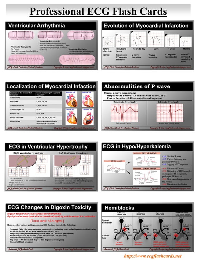 Ecg flash cards_new_complete | PDF