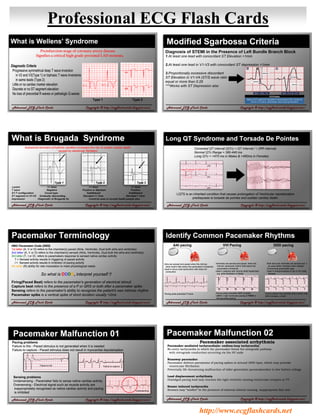 Ecg flash cards_new_complete | PDF | Heart and Cardiovascular Diseases ...