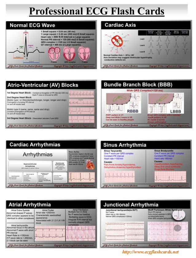 Ecg flash cards_new_complete