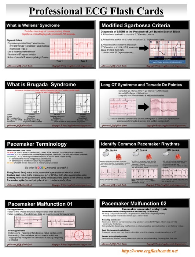 Ecg flash cards_new_complete