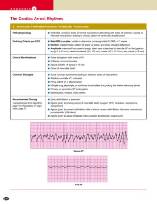 Ecg for acls | PDF