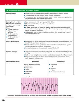 Ecg for acls | PDF