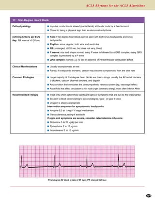 Ecg for acls | PDF