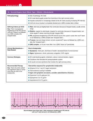 Ecg for acls | PDF