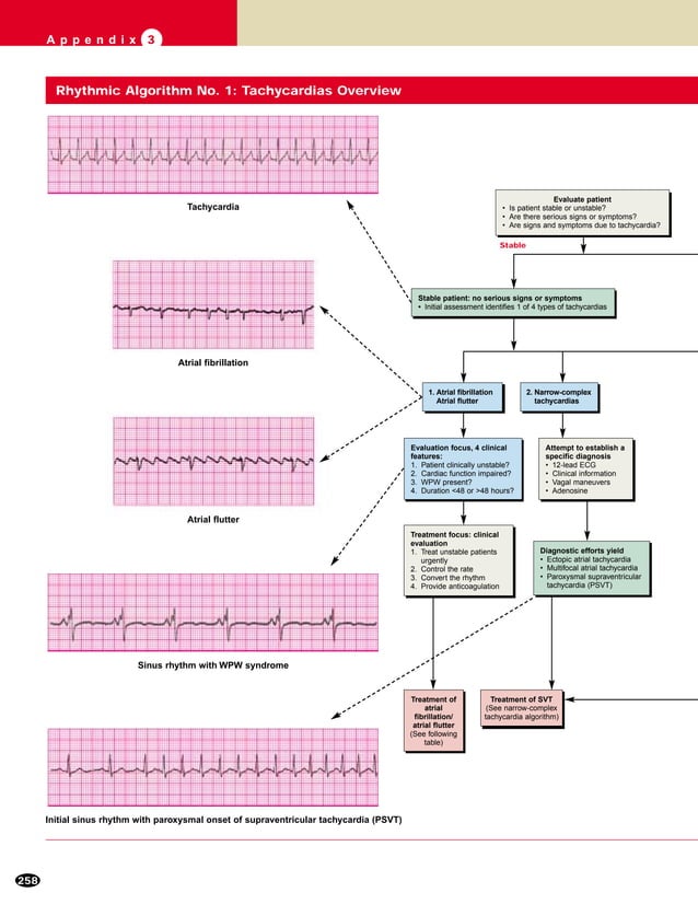 Ecg for acls | PDF | Heart and Cardiovascular Diseases | Diseases and Conditions