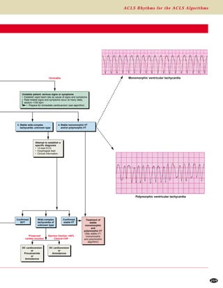 Ecg for acls | PDF | Heart and Cardiovascular Diseases | Diseases and ...