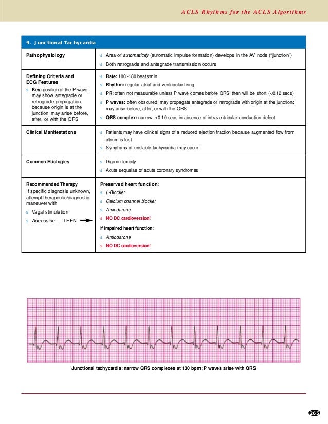 Ecg for acls