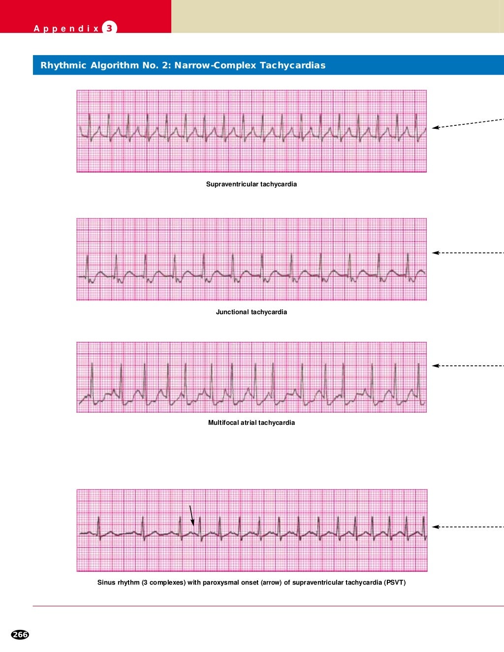 Ecg for acls
