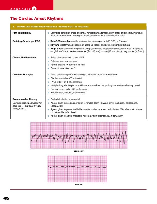 Ecg for acls