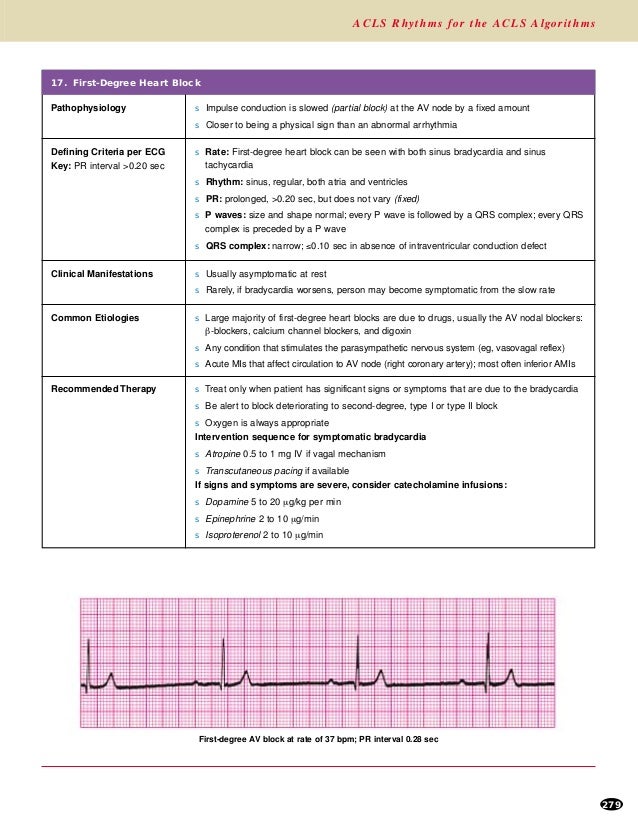 Ecg for acls