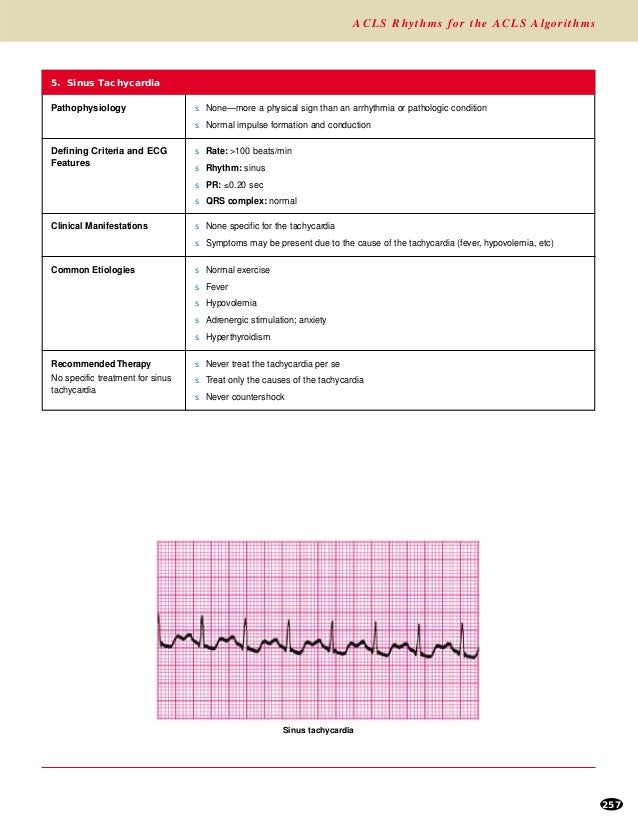 Ecg for acls