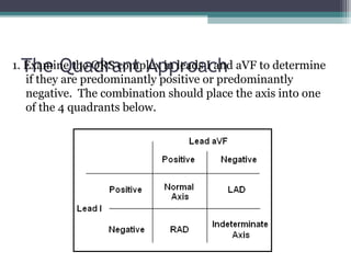 Ecg for beginners | PPT