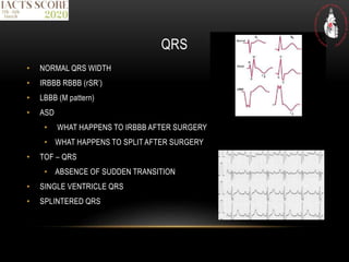 ECG for Cardiothoracic Surgeons | IACTS SCORE 2020 | PPT