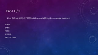 ECG FOR DISCUSSION (Monomorhic VT.).pptx