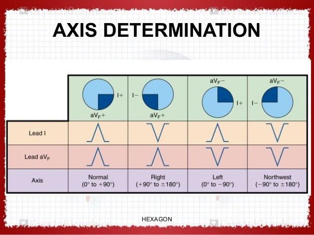 ECG for Final Part 2 WHH
