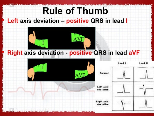 ECG for Final Part 2 WHH