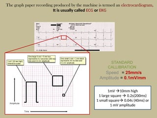 ecg for noob ecg interpretation ecg recall | PPT