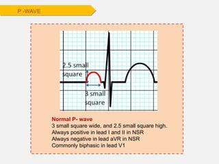 ecg for noob ecg interpretation ecg recall | PPT