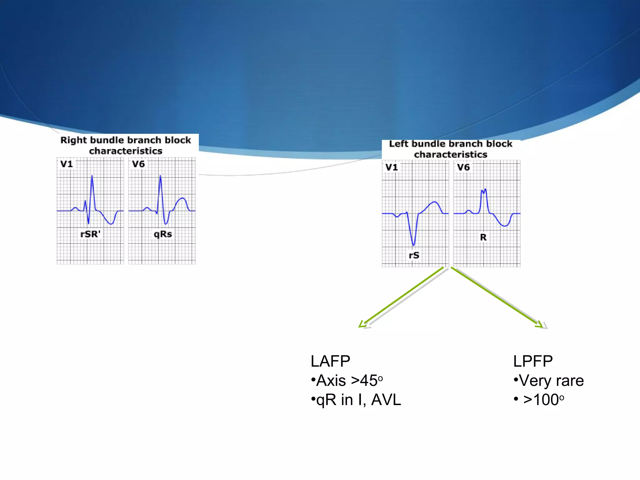 Principles of ECG Interpretation | PPT | Heart and Cardiovascular ...
