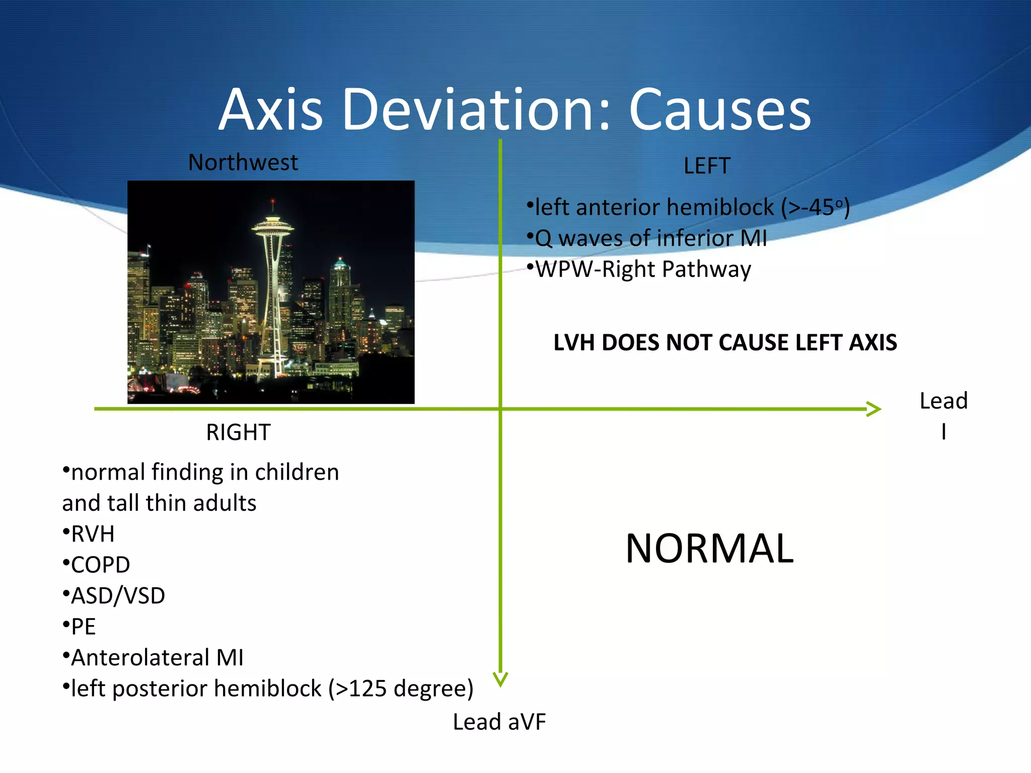 Principles of ECG Interpretation | PPT