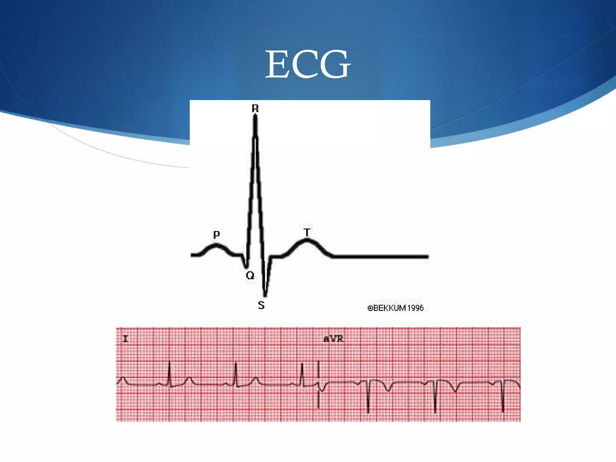 Principles of ECG Interpretation | PPT | Heart and Cardiovascular ...