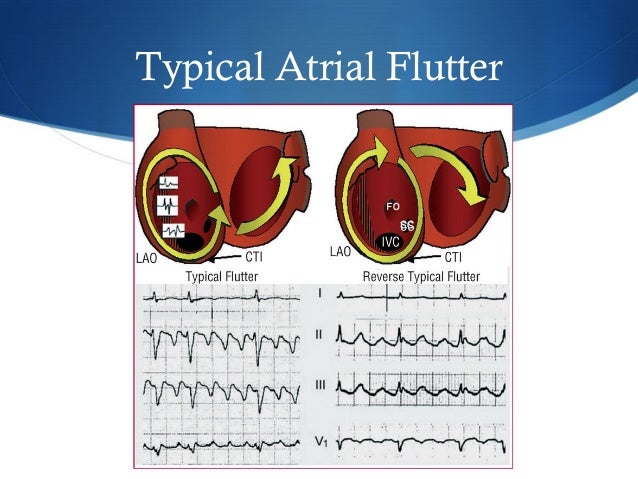 Principles of ECG Interpretation