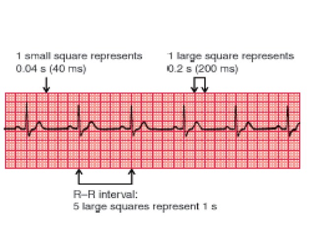 ECG details- for Students | PPT