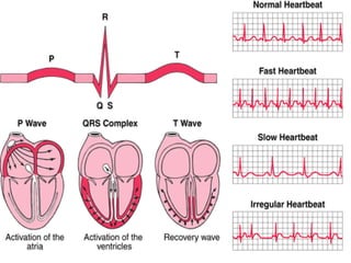 ECG details- for Students | PDF