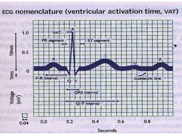 ECG details- for Students | PPT