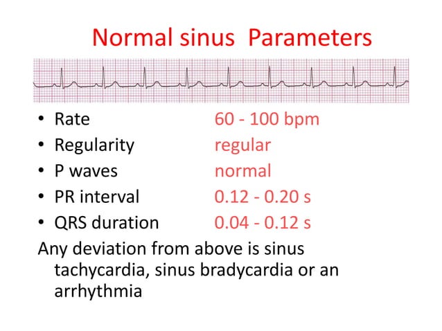 ECG details- for Students | PPT