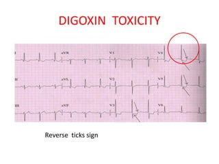 ECG details- for Students | PPT