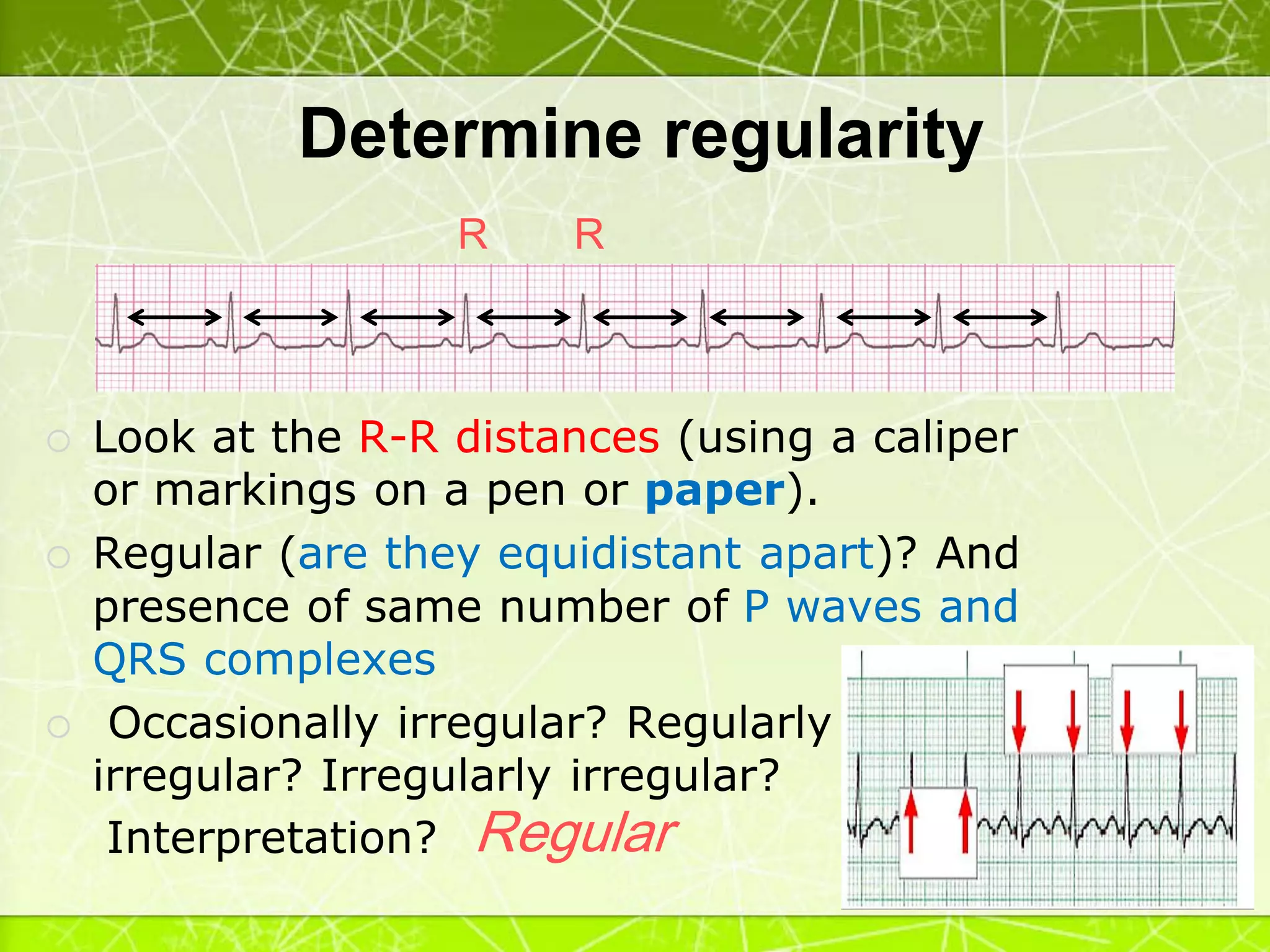 Ecg fundamentals | PDF