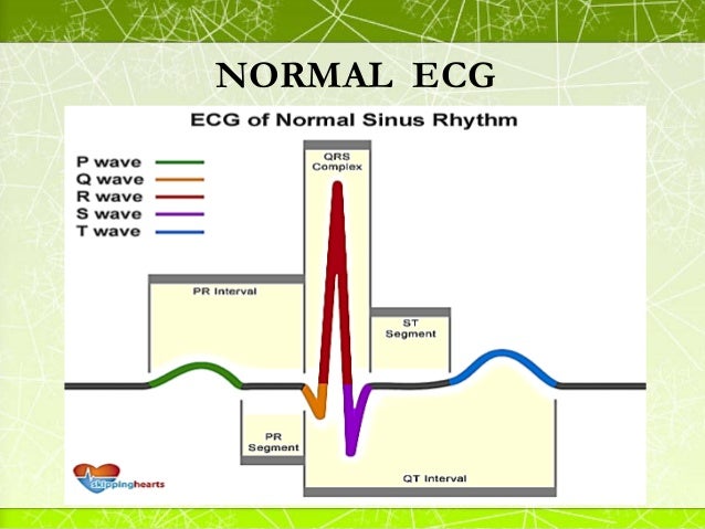 Ecg fundamentals