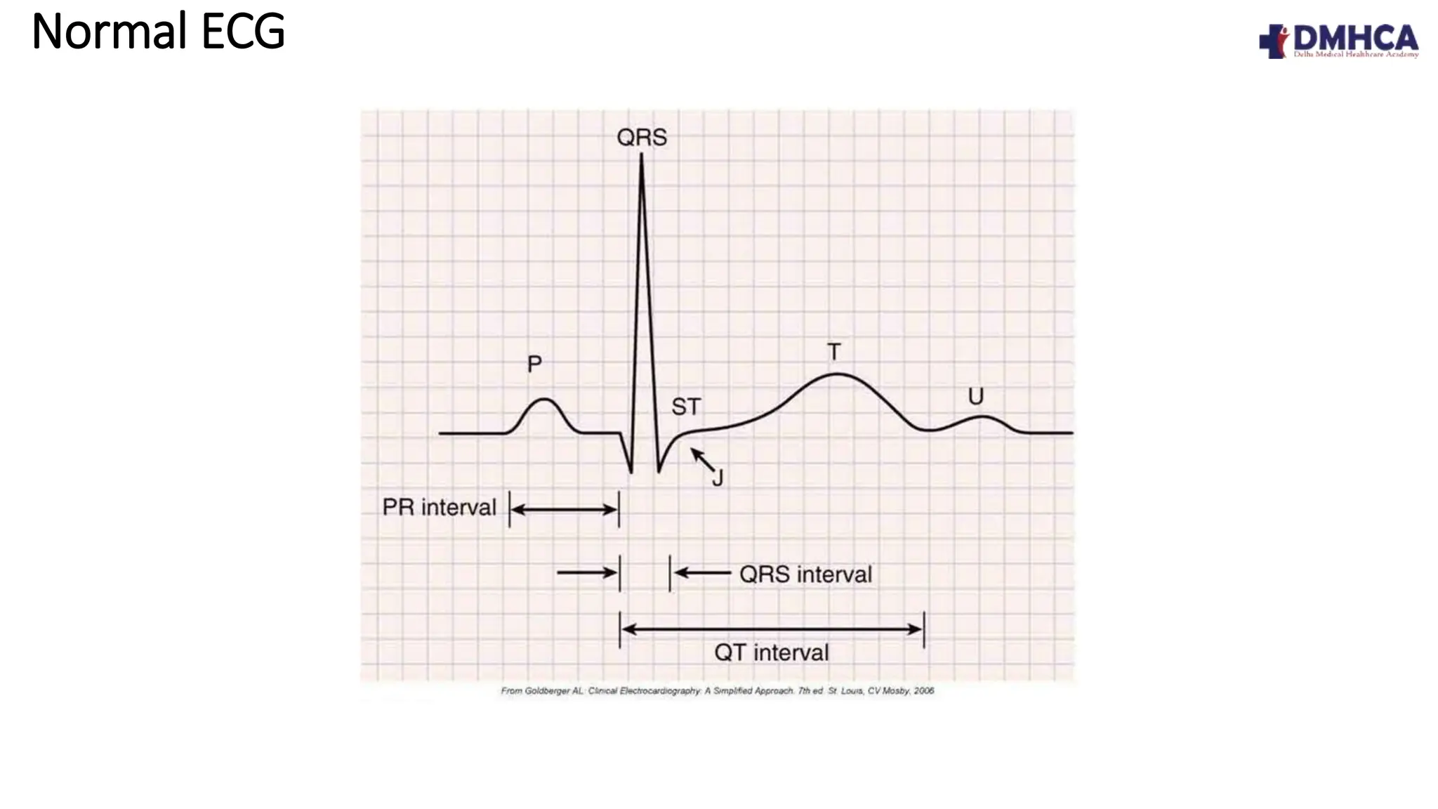 ECG Fundamentals.pptx