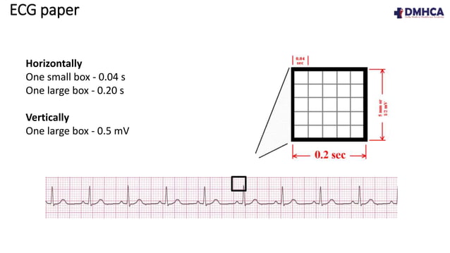 ECG Fundamentals.pptx