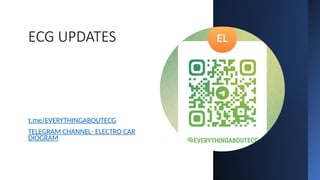 ECG learning made easy.medicine and pediatrics | PPT