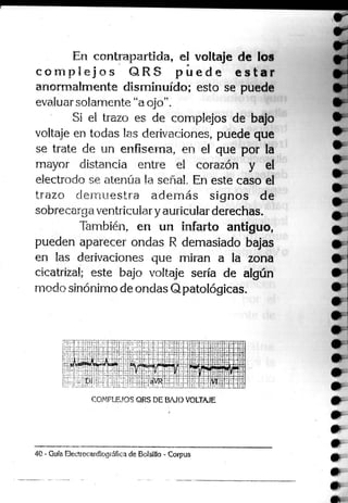 Ecg guia de bolsillo para su interpretacion (1) | PDF