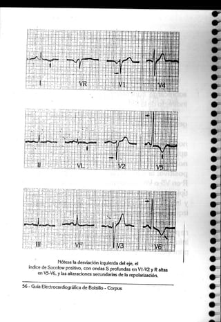 Ecg guia de bolsillo para su interpretacion (1) | PDF
