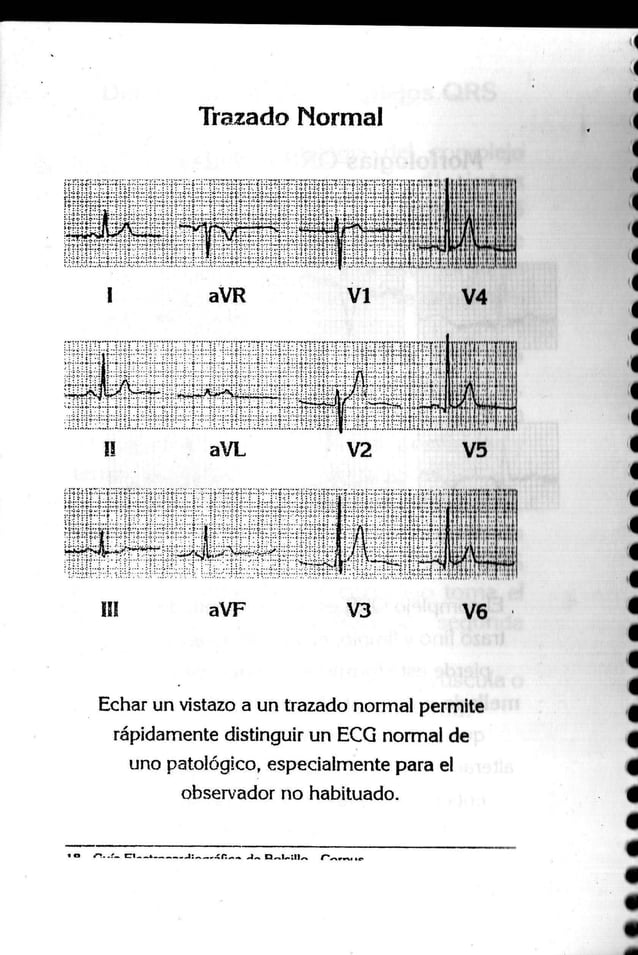 Ecg guia de bolsillo para su interpretacion booksmedicos.org