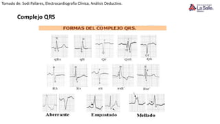 ECG Interpretación Básica | PDF