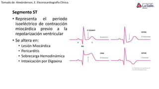 ECG Interpretación Básica | PDF