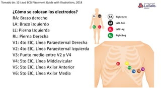 ECG Interpretación Básica | PDF