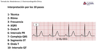 ECG Interpretación Básica | PDF