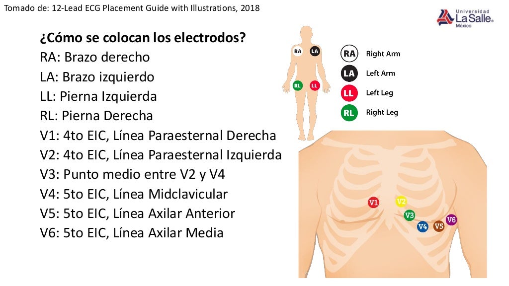 ECG Interpretación Básica