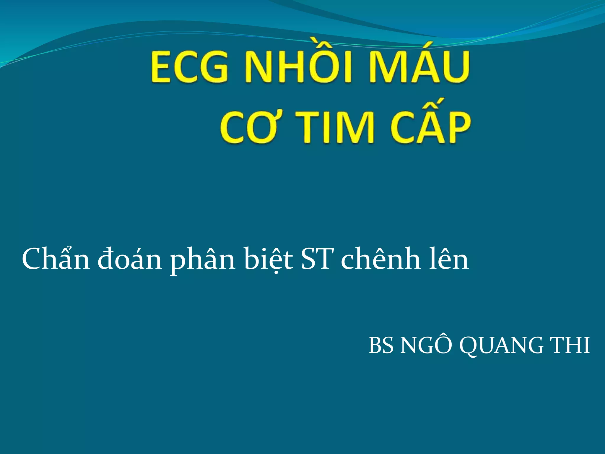 ECG hội chứng vành cấp - 2.pptx