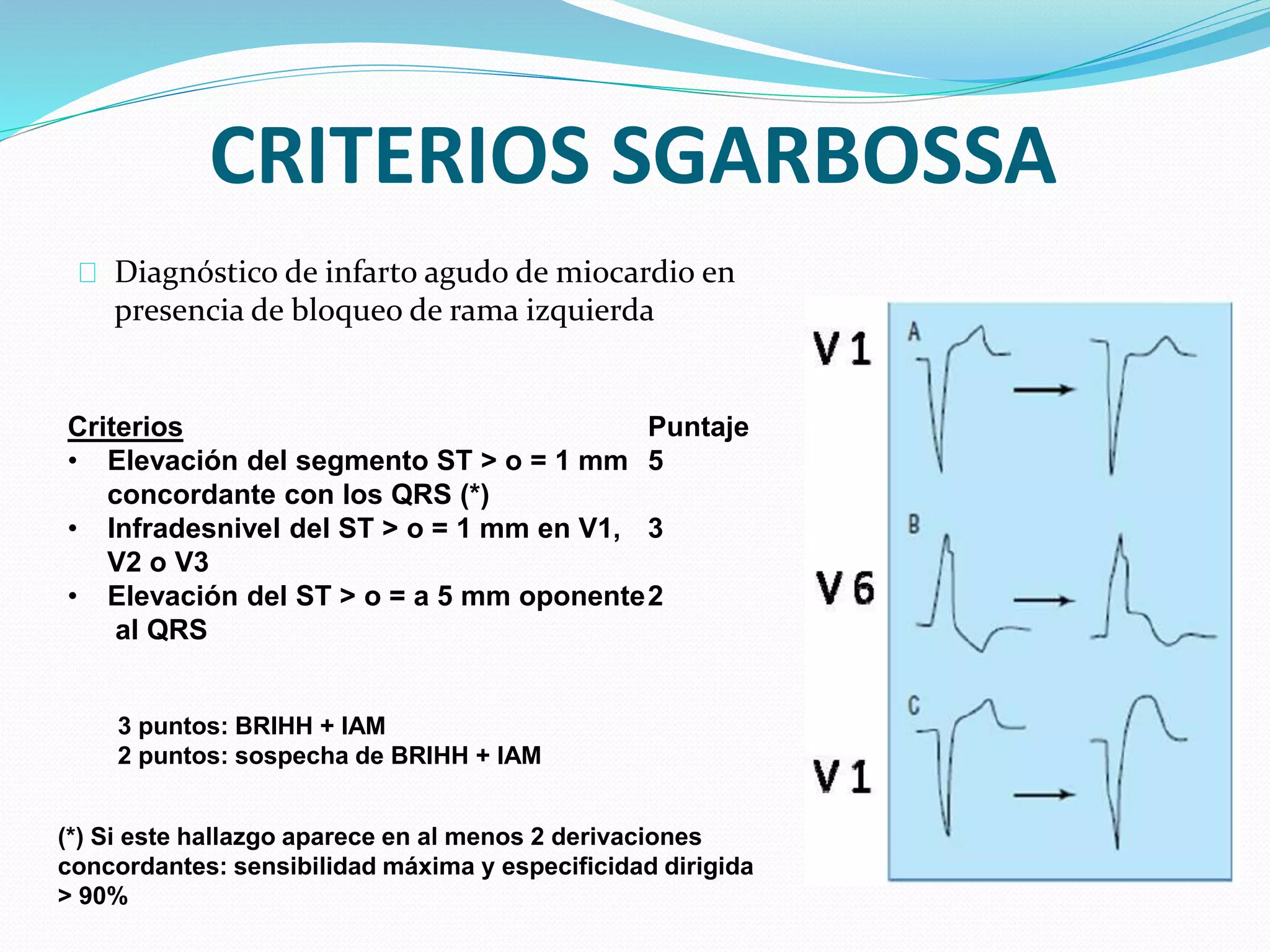 Electrocardiograma (ECG) en Infarto de Miocardio (IAM) - Dr. Bosio | PPTX