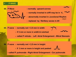 Ecg | PPTX