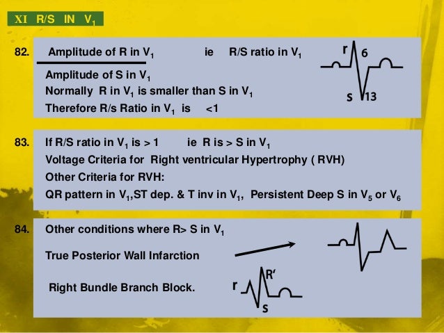 Ecg